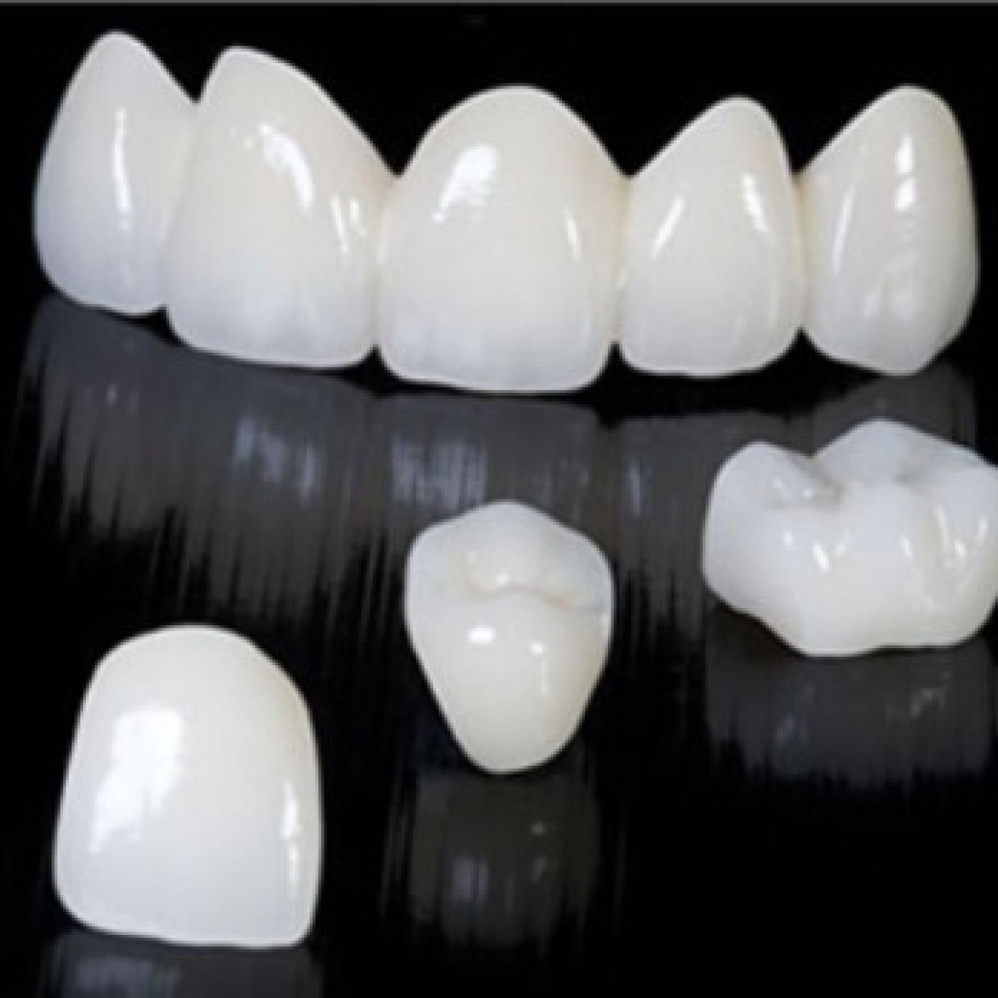 Metal Free Crown & Bridge | Utica, Syracuse, Schenectady, NY: Biogenic ...